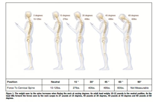 Posture, The 60lb Head and Migraines