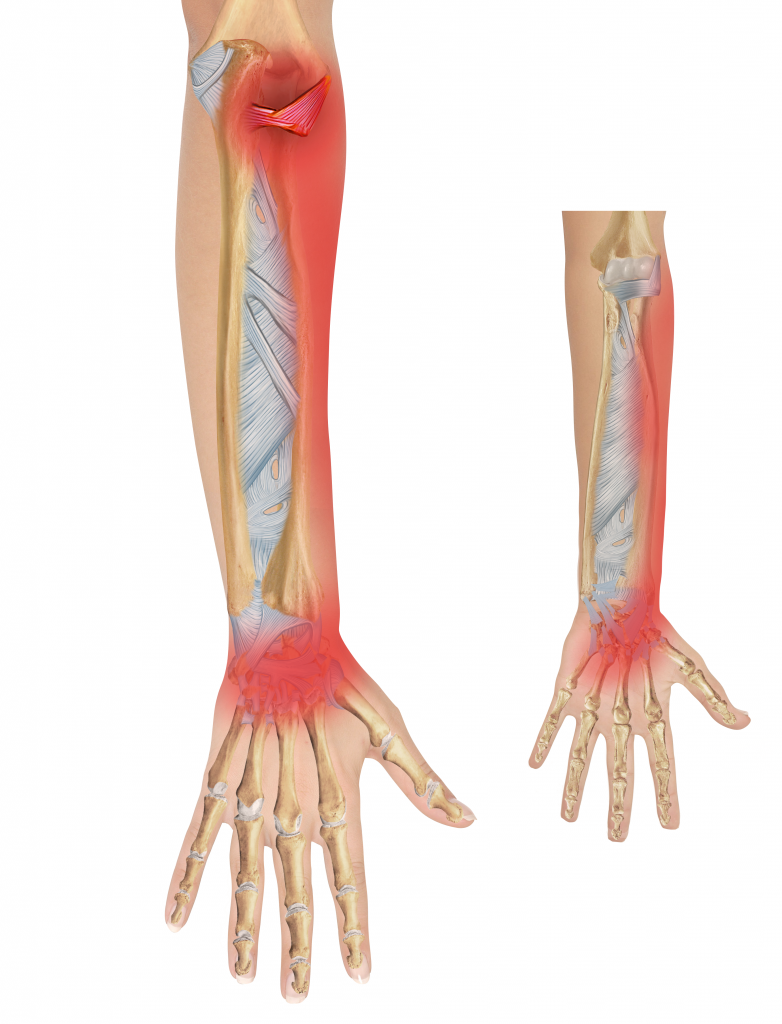 Anatomy of the Lateral Elbow Part 2